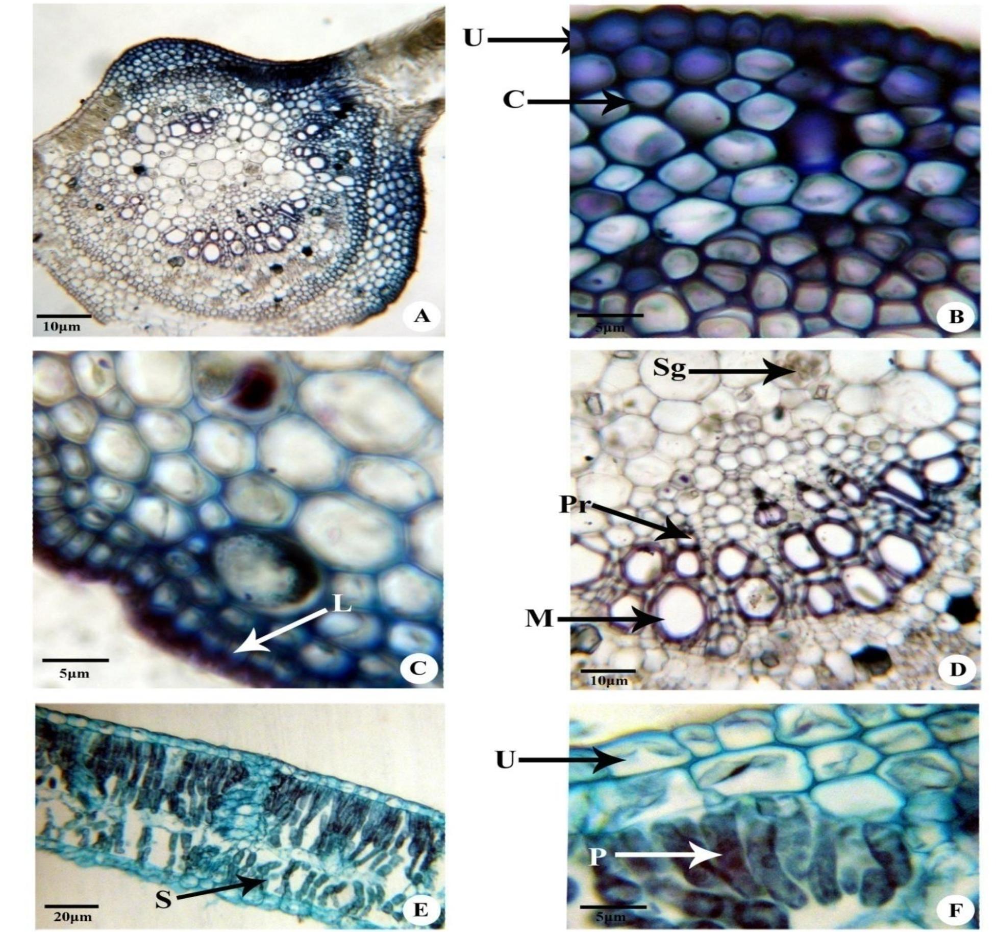 Microscopic images of transverse sections of leaves of e.