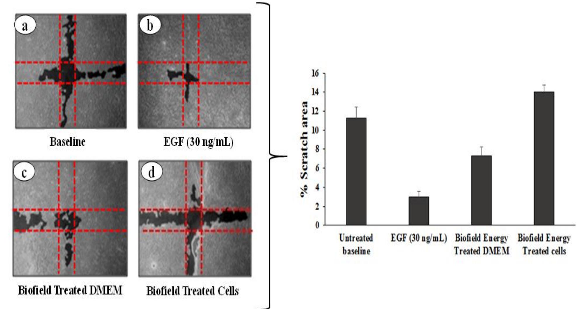 Cell migration potential of biofield energy treatment on
