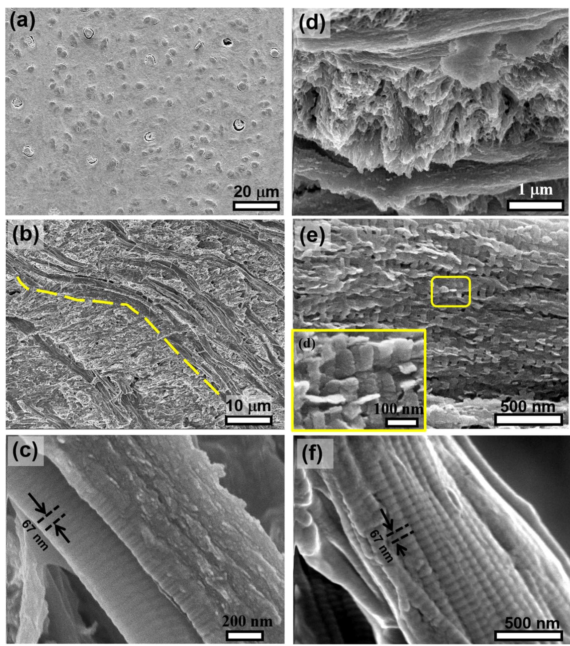 11. the structure of bony layer of alligator gar fish scale.