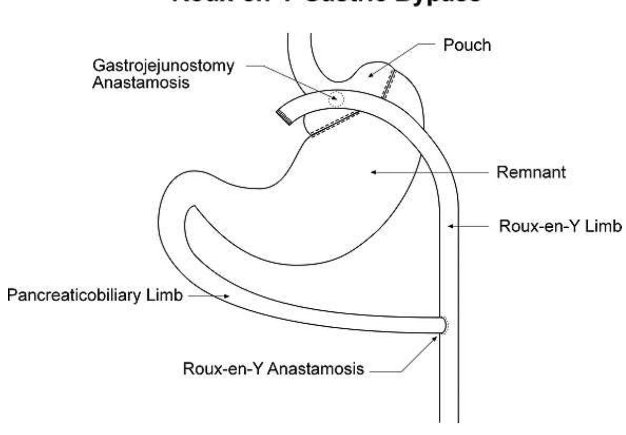 Diagram showing normal roux-en-y surgical anatomy.