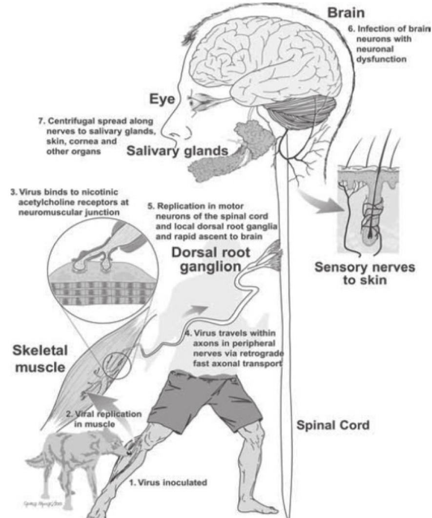 Schematic diagram showing the sequential steps in the