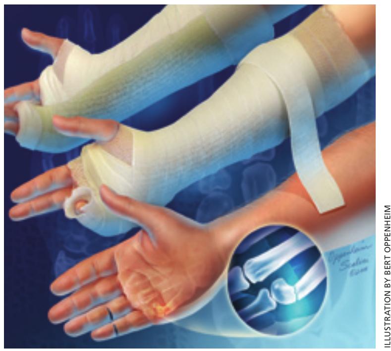 (PDF) Principles of Casting and Splinting