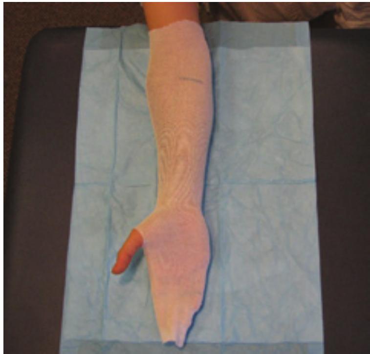 Figure 4 - Principles of Casting and Splinting
