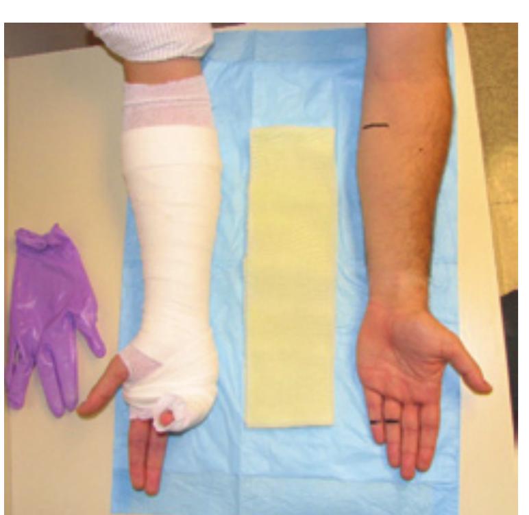(PDF) Principles of Casting and Splinting