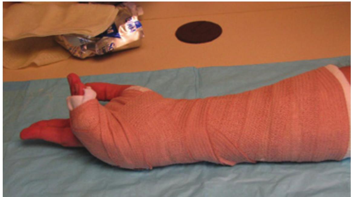 (PDF) Principles of Casting and Splinting