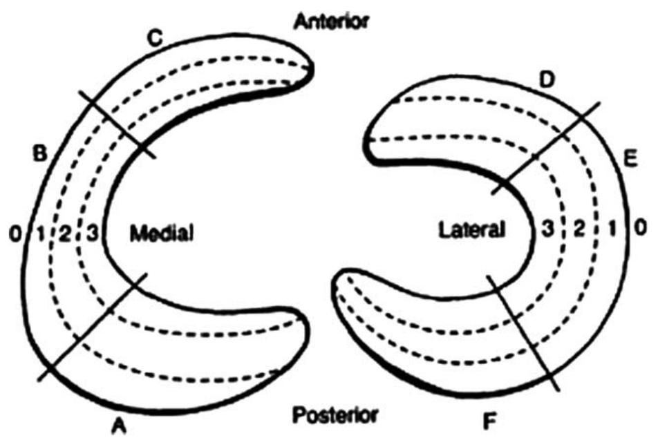 Zone classification of the meniscus. posterior third zone of
