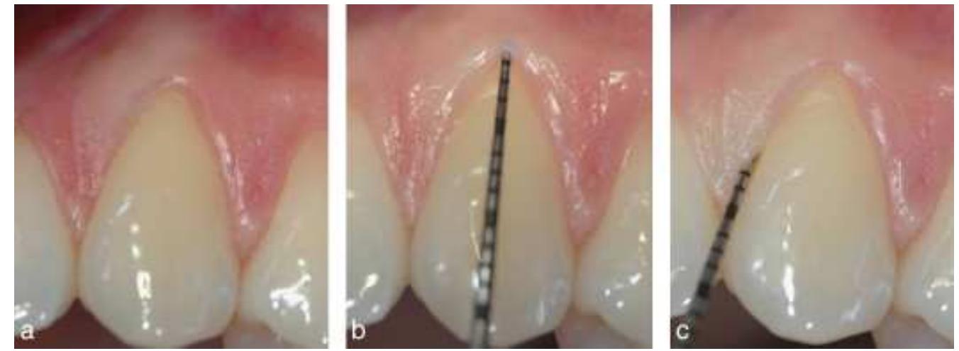 (PDF) Cairo et al 2011 Journal of Clinical Periodontology