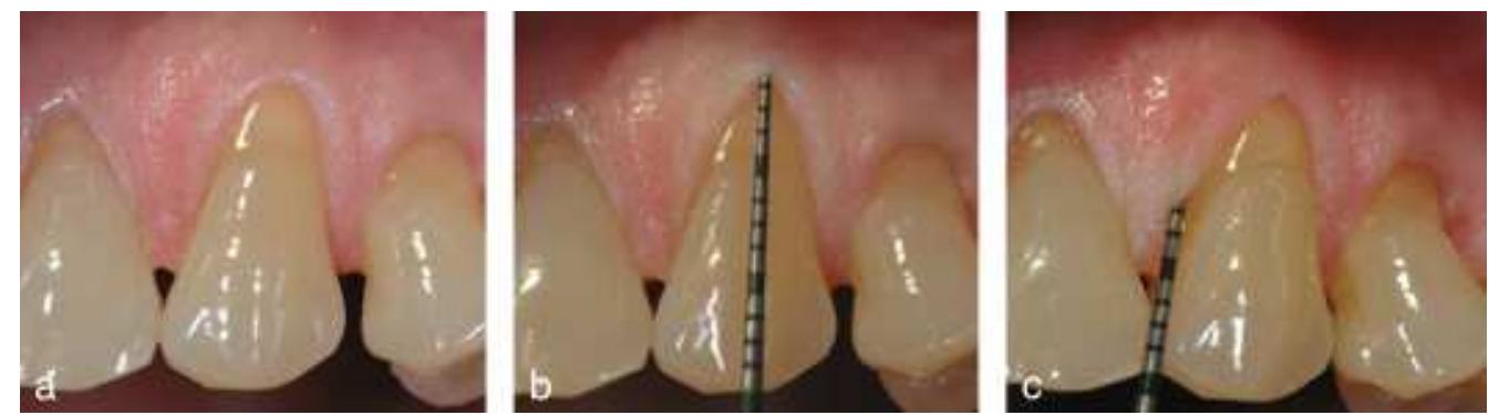 (PDF) Cairo et al 2011 Journal of Clinical Periodontology