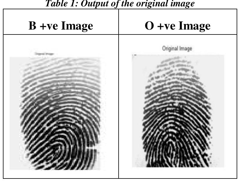 The clarity of ridges and valley structure in the