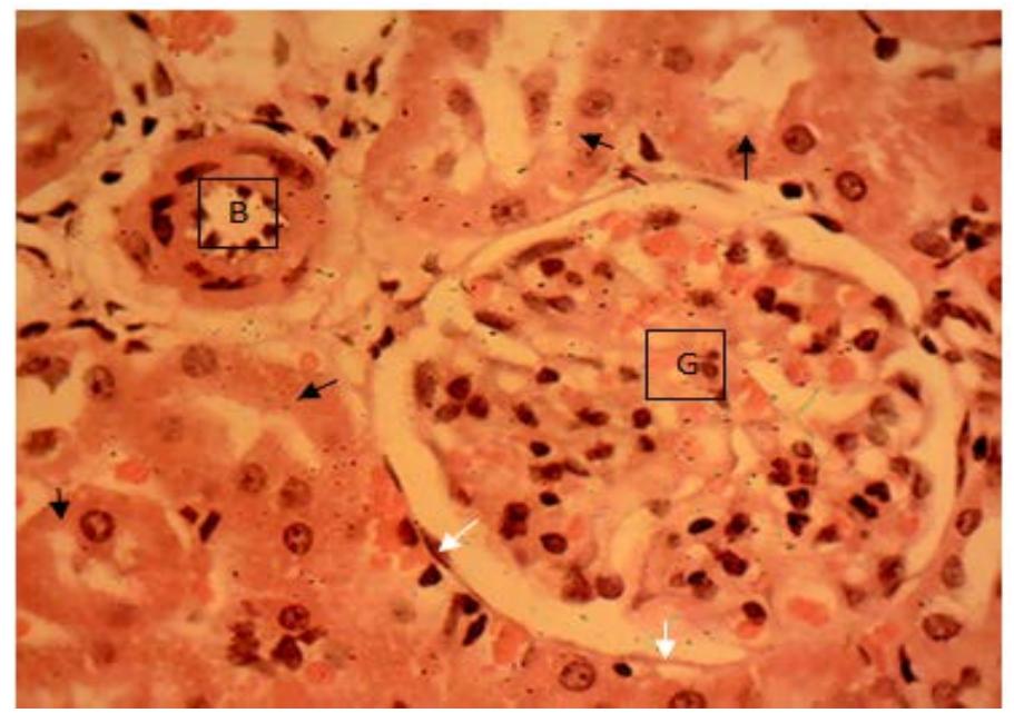 Kidney histomorphology of a normal control rat administered
