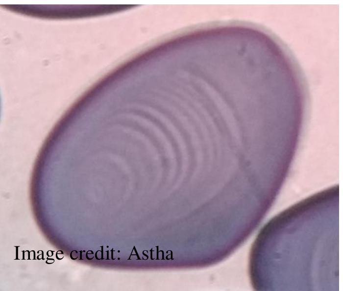 (PDF) A study of Microscopic characteristics of Starch granules
