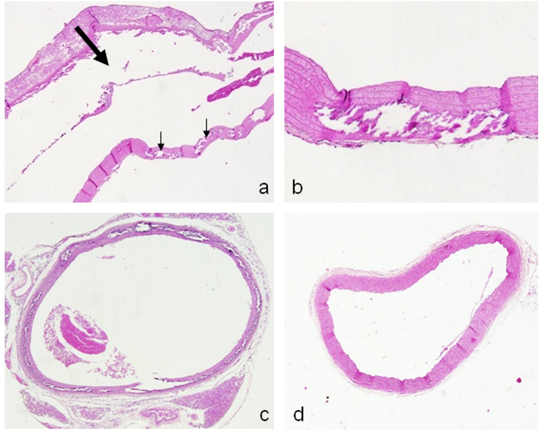 Pattern of aortic calcification in rats with renal failure.
