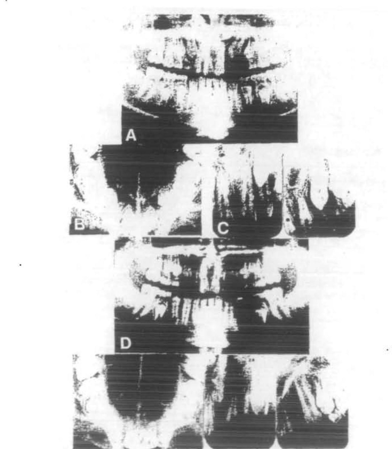 Orthopantomogram (a), intra-oral axial-vertex radiograph (b)