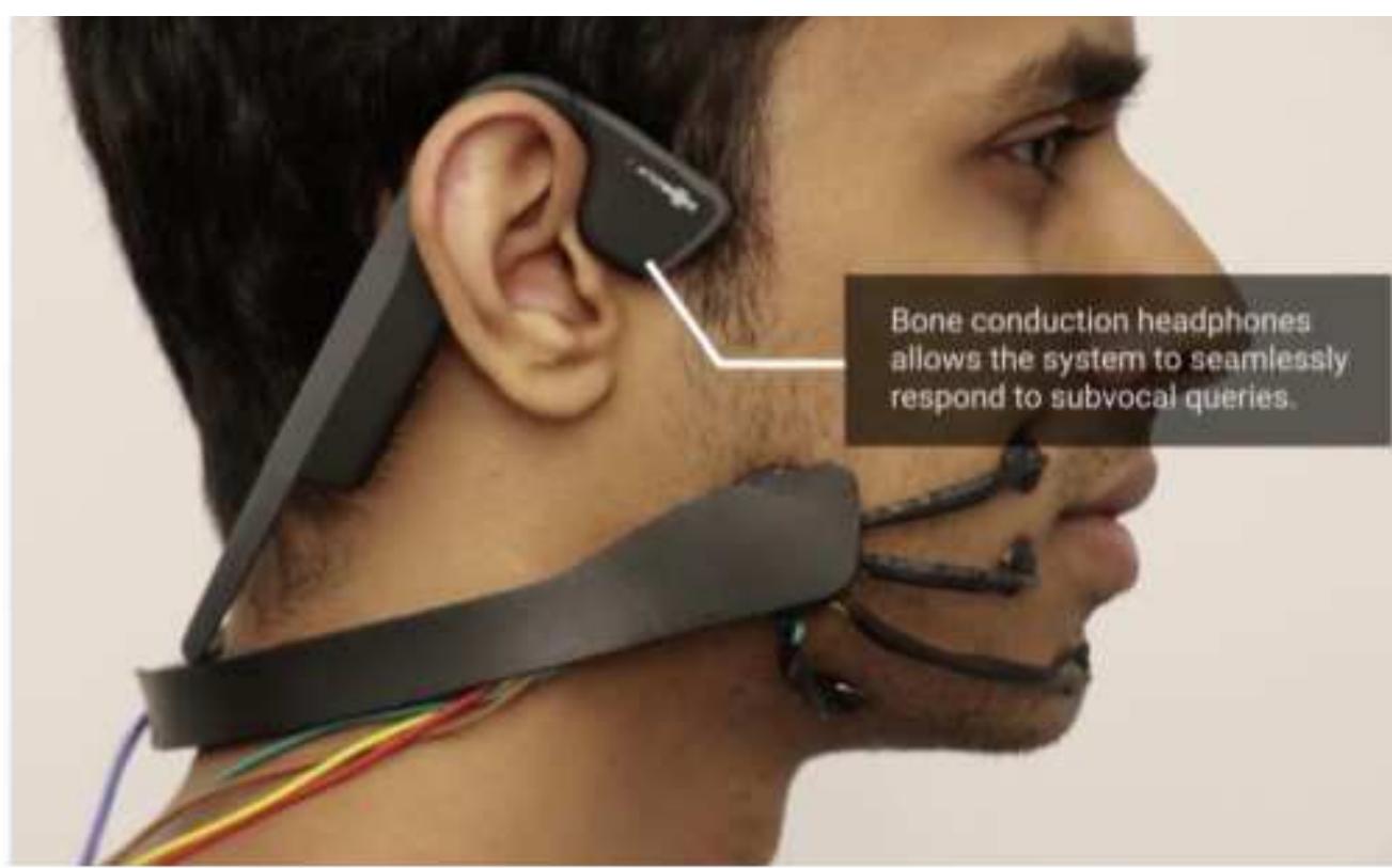 Side profile of the alterego system with the bone conduction