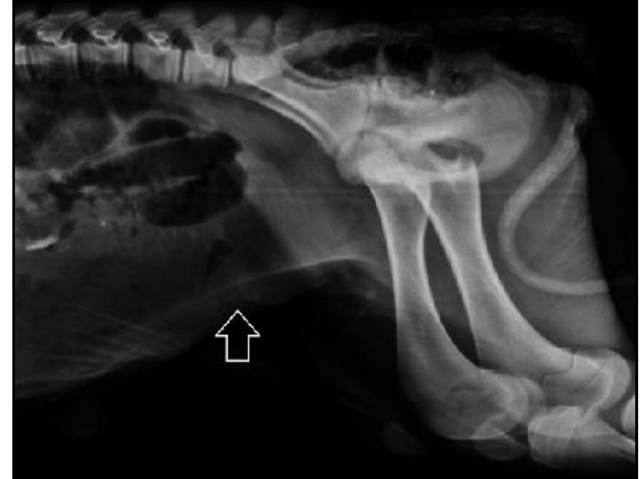 Plain radiograph of lateral abdomen and pelvis show- ing
