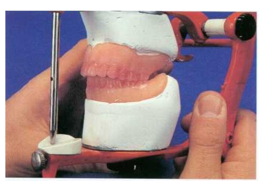Standard copy denture technique-template. fig. 66 templates