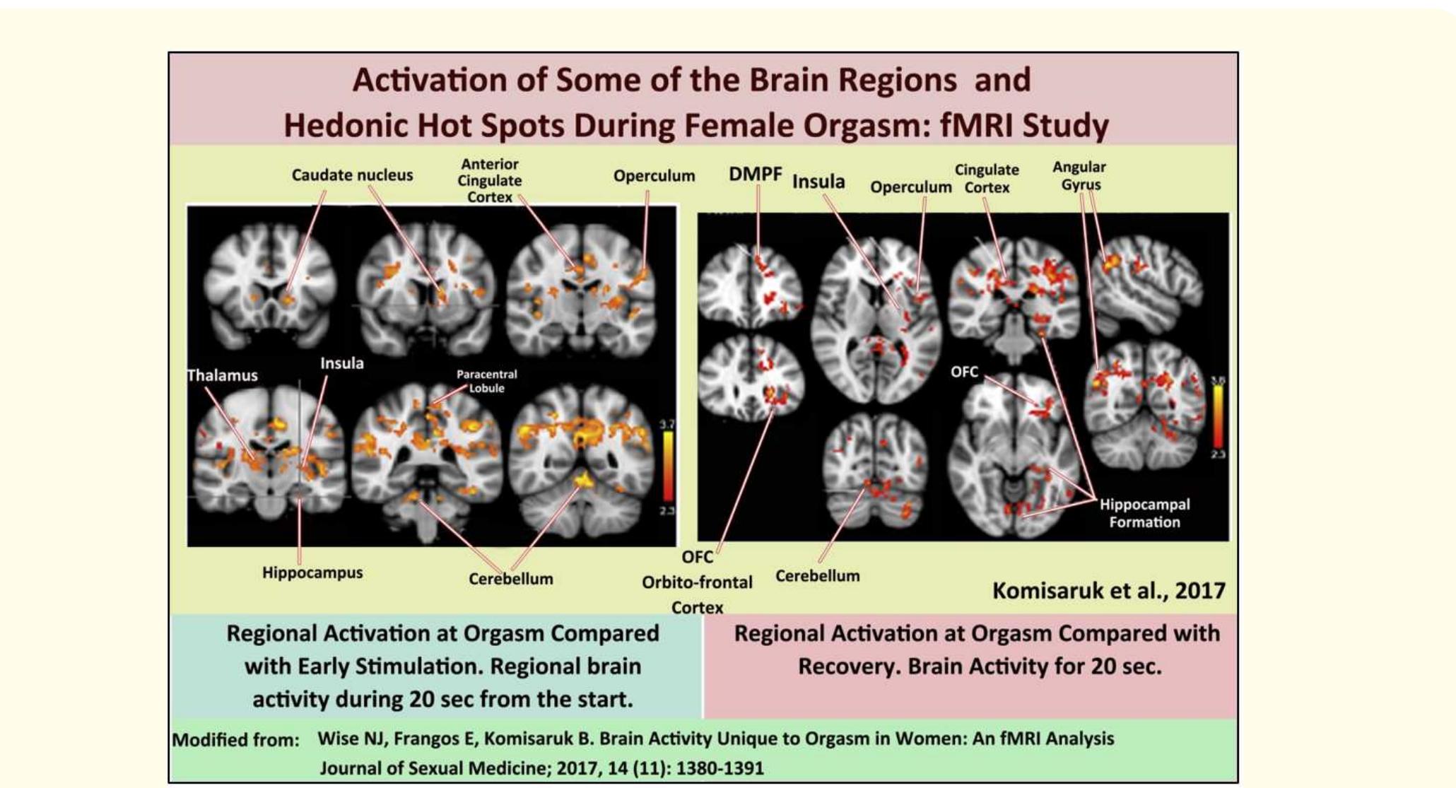 Figure 3 - from EC NEUROLOGY Review Article Neurological
