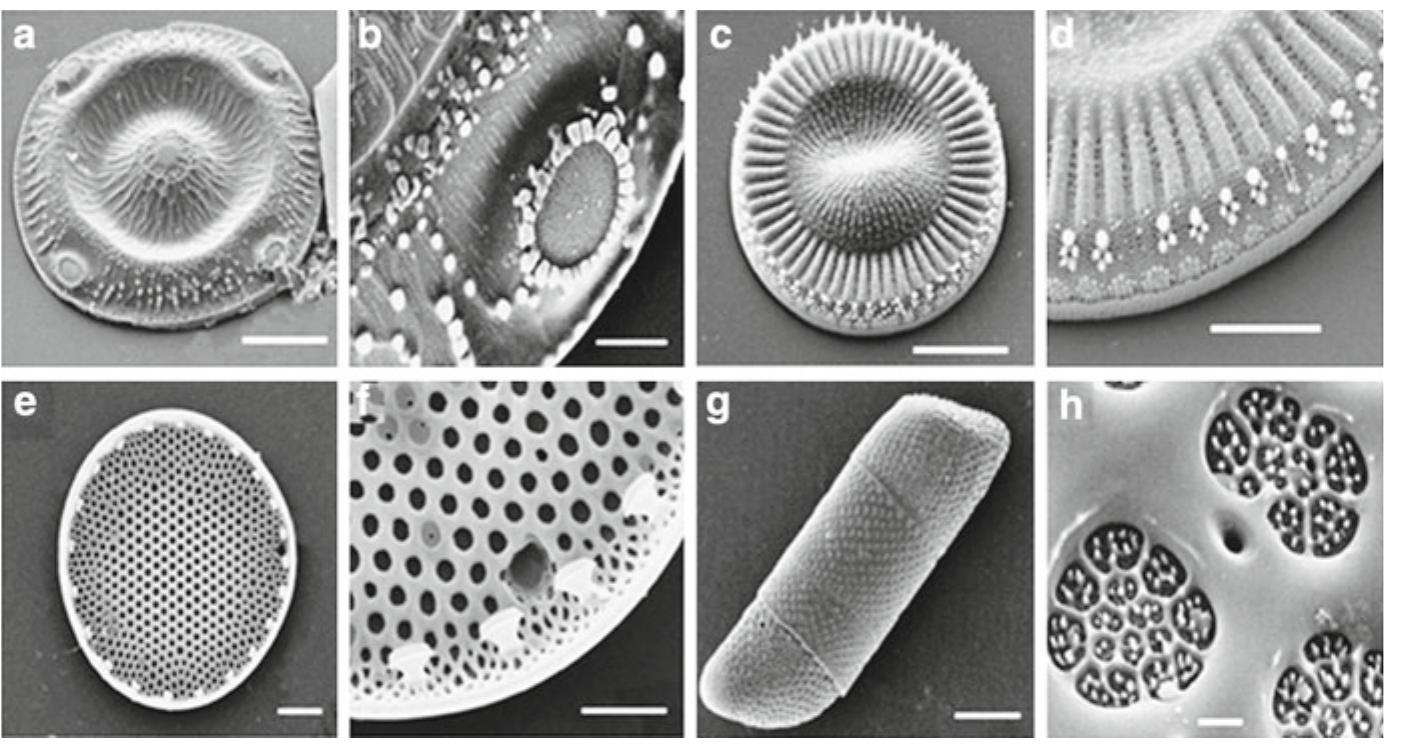 6 transmission electron microscopic images of marine centric