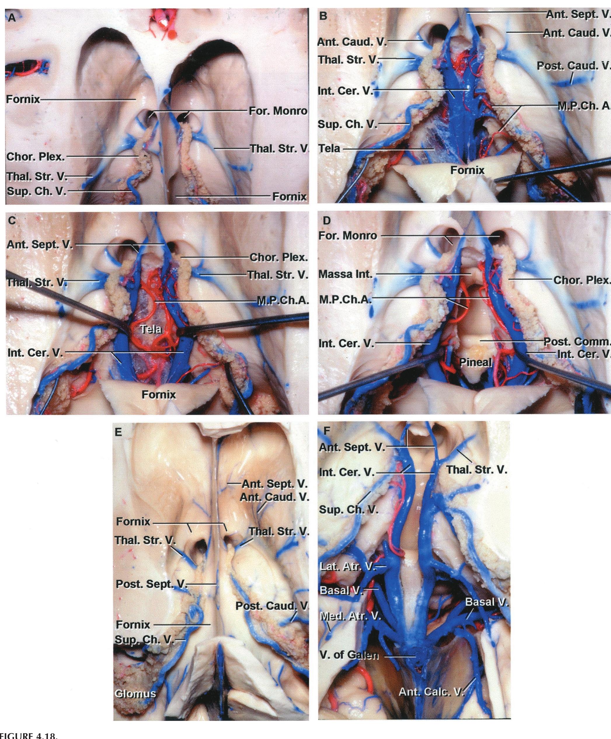 Figure 30 - THE CEREBRAL VEINS