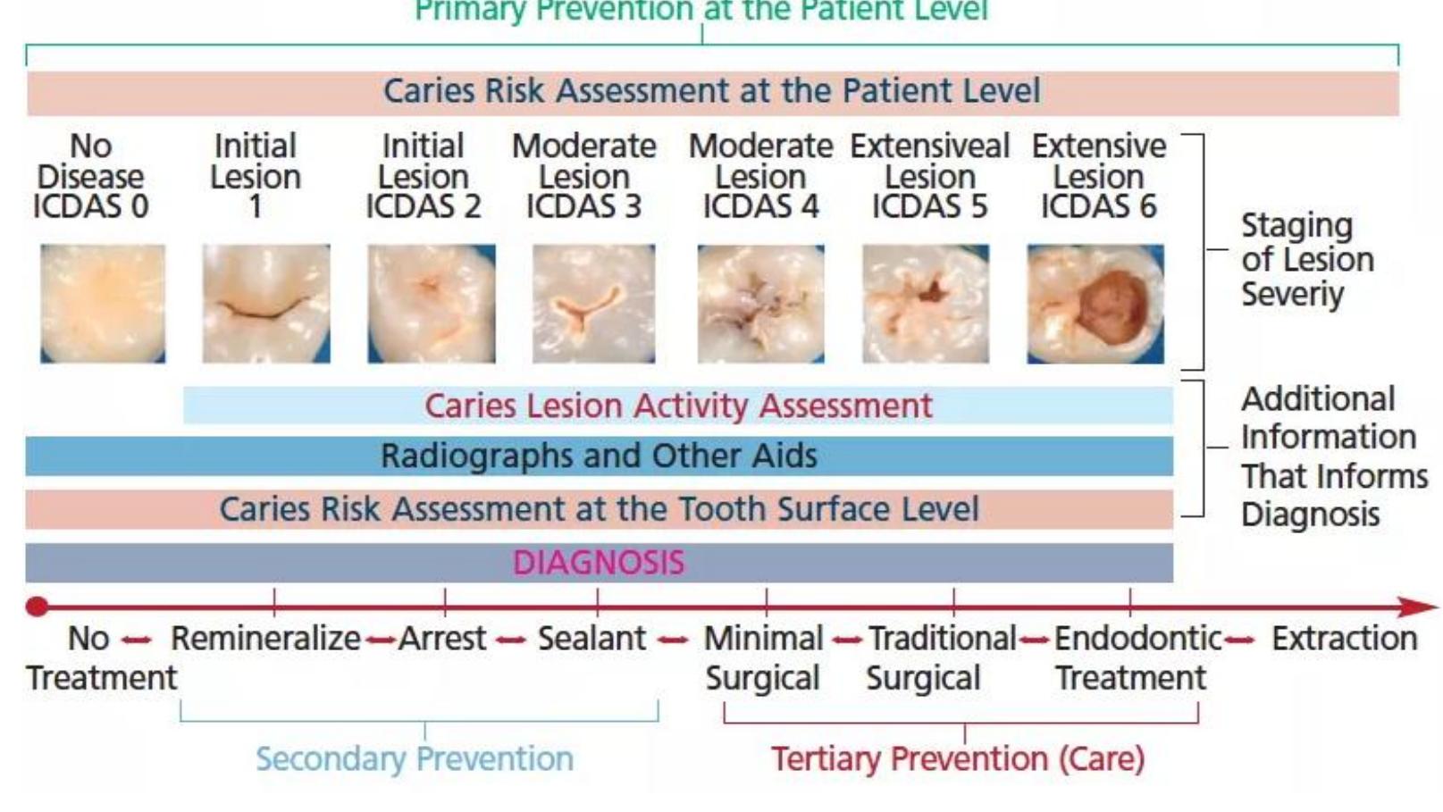 ‘igure 1 international caries detection and assessment