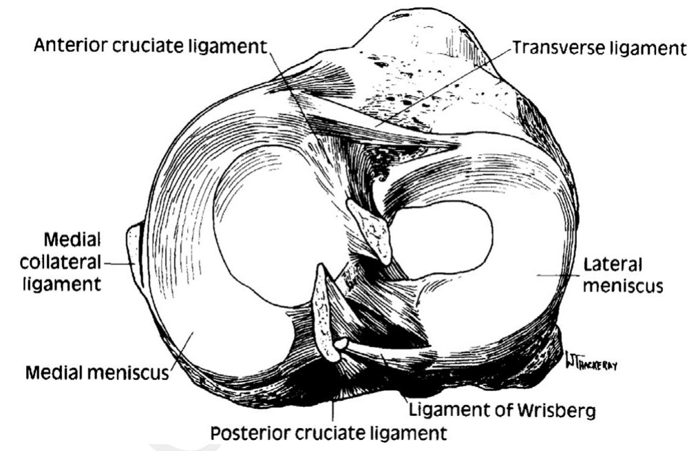 Drawing of the tibial plateau showing the shape and at-