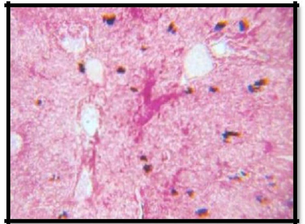 Histopathology of liver tissues of healthy fish figure 7: