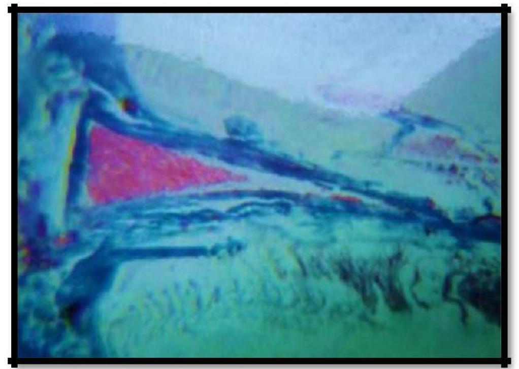 Histological section of diseased gill (h &e) (gill arches)