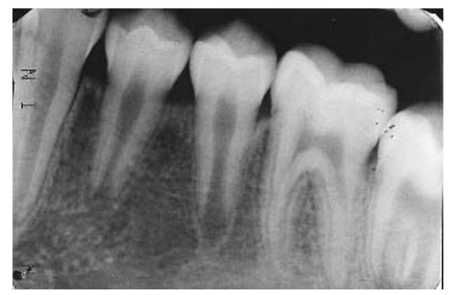 Figure 2 - from The implications of the David Glass case for