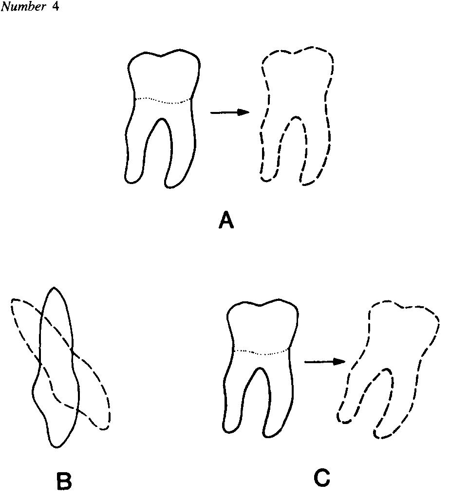 (PDF) Mechanics of tooth movement