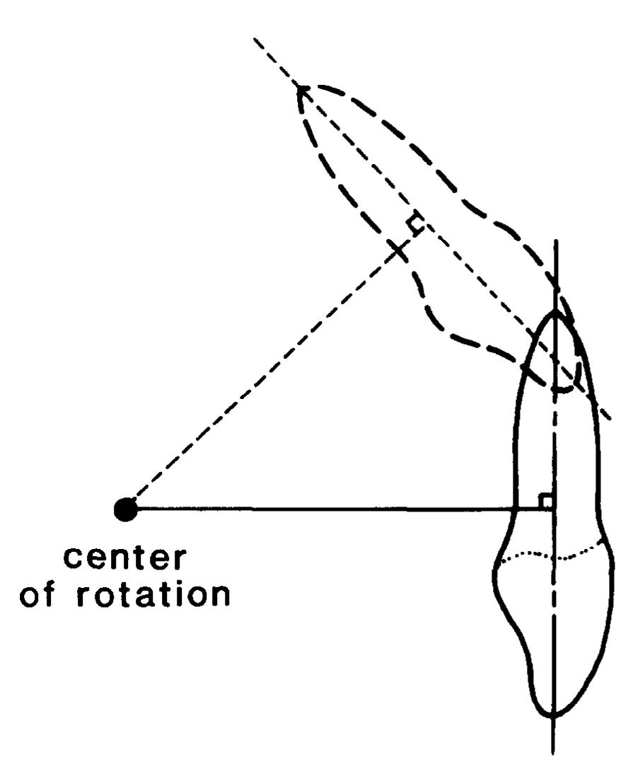 (PDF) Mechanics of tooth movement