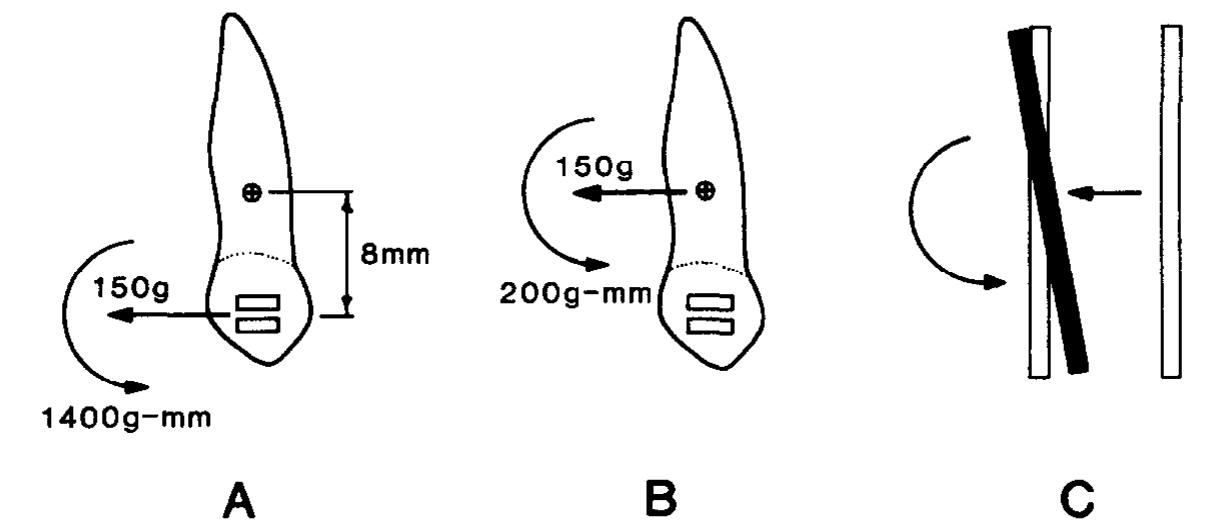 (PDF) Mechanics of tooth movement