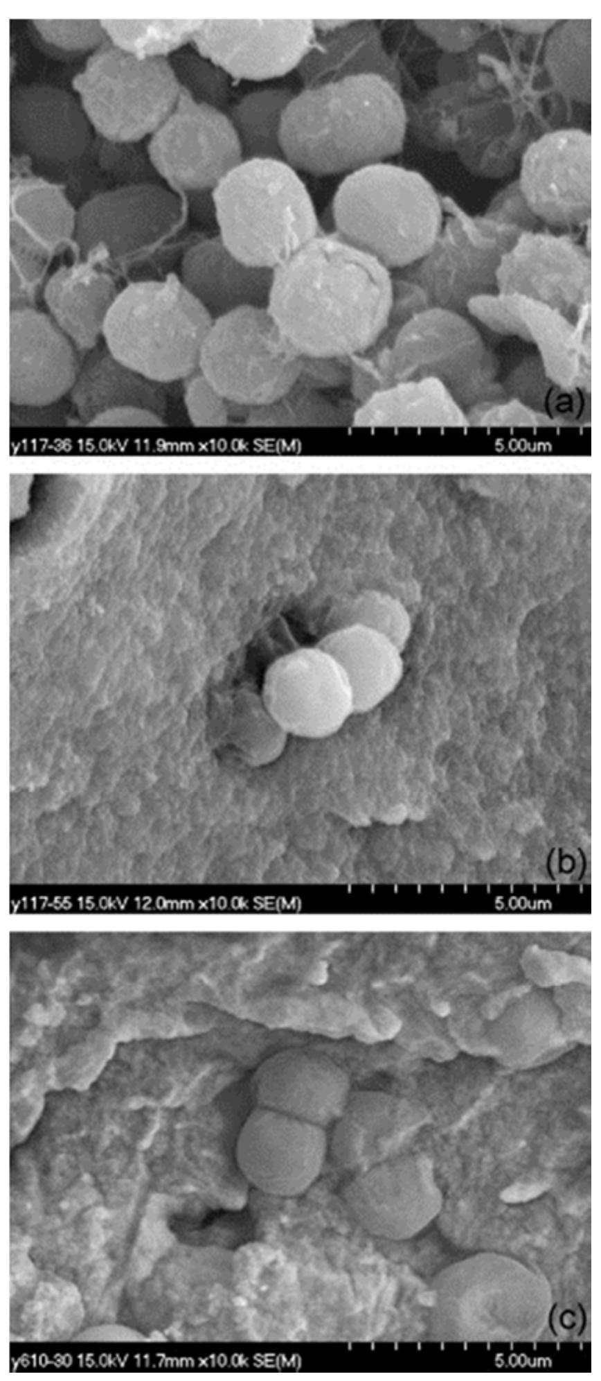 Sem images of fresh algae cells (a), algae cells treated by