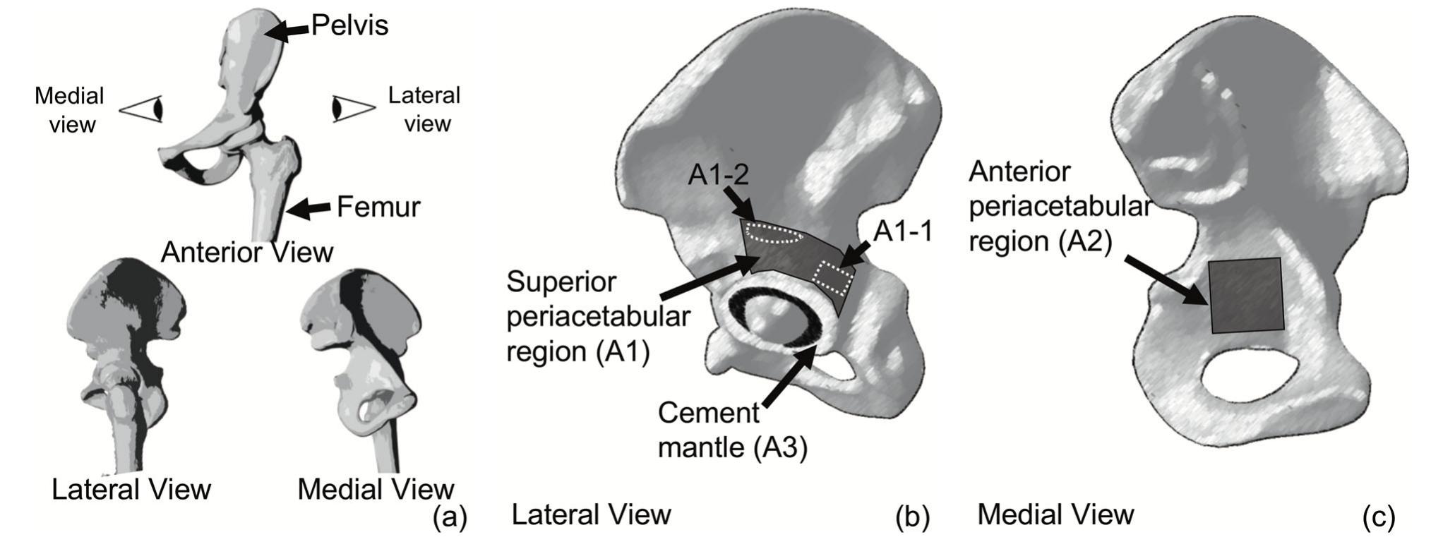 Regions of interest. (a) anterior, lateral and medial view
