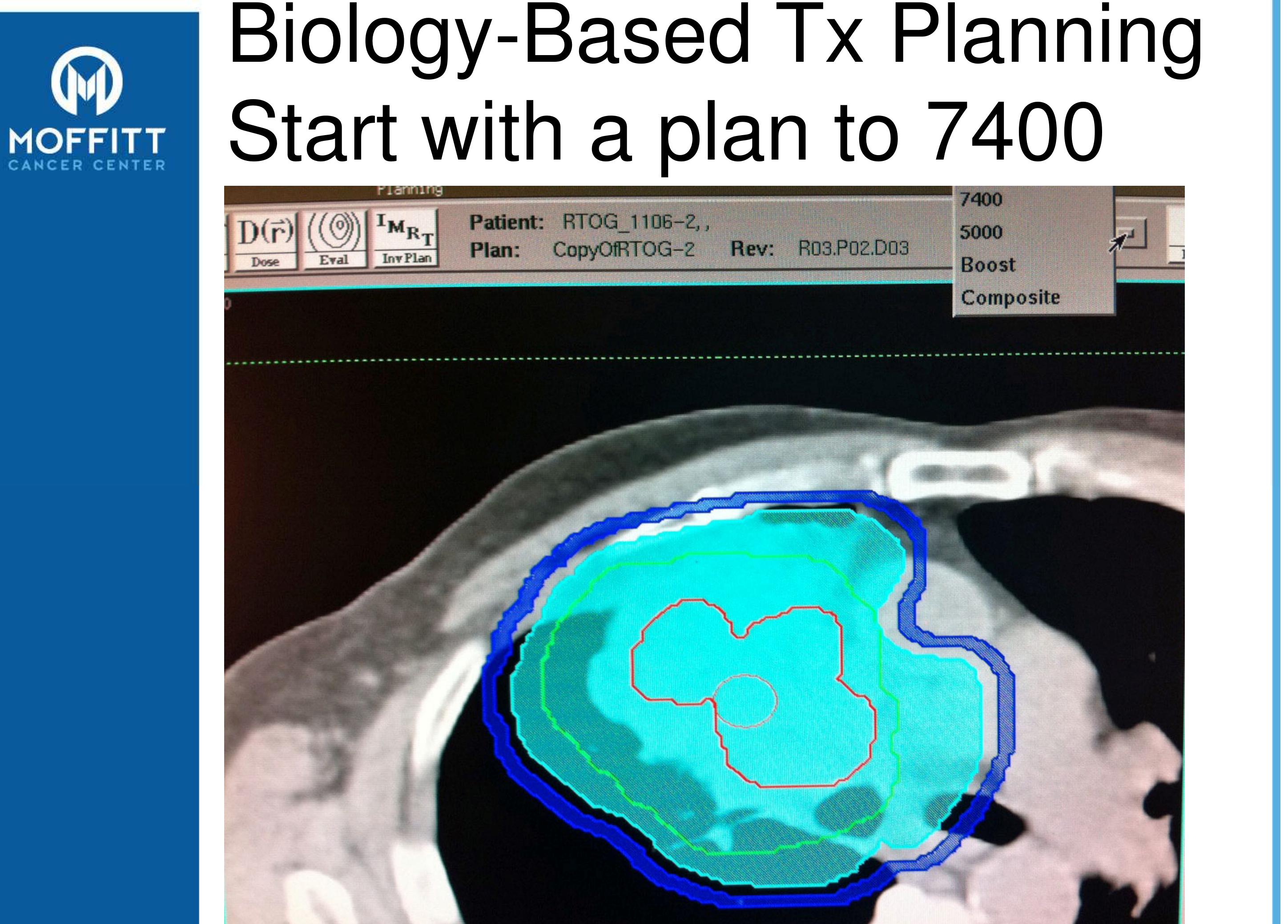 Figure 43 - A Review Of QUANTEC Normal Tissue Tolerances