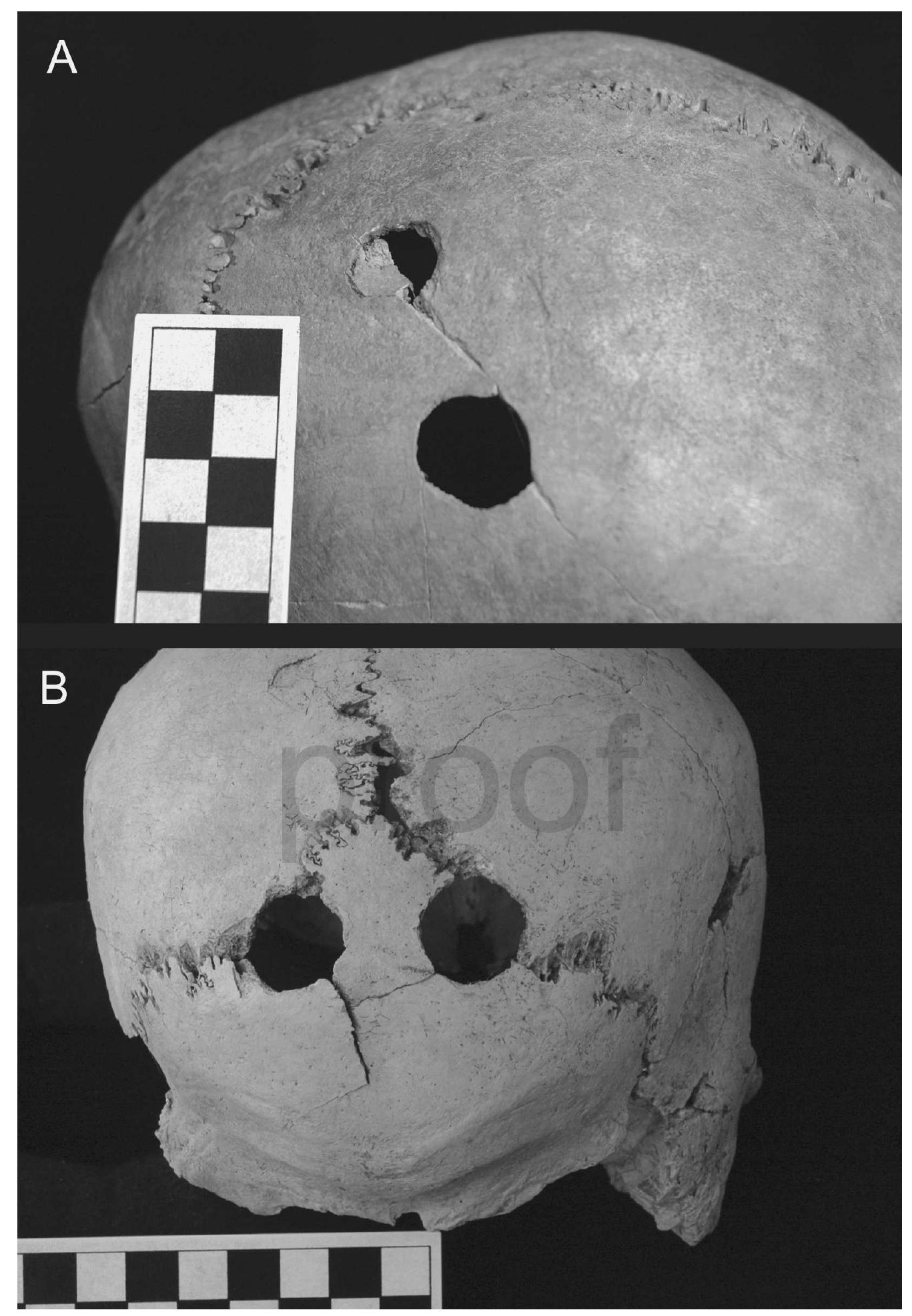 5. photographs of perimortem cranial trauma from nearby