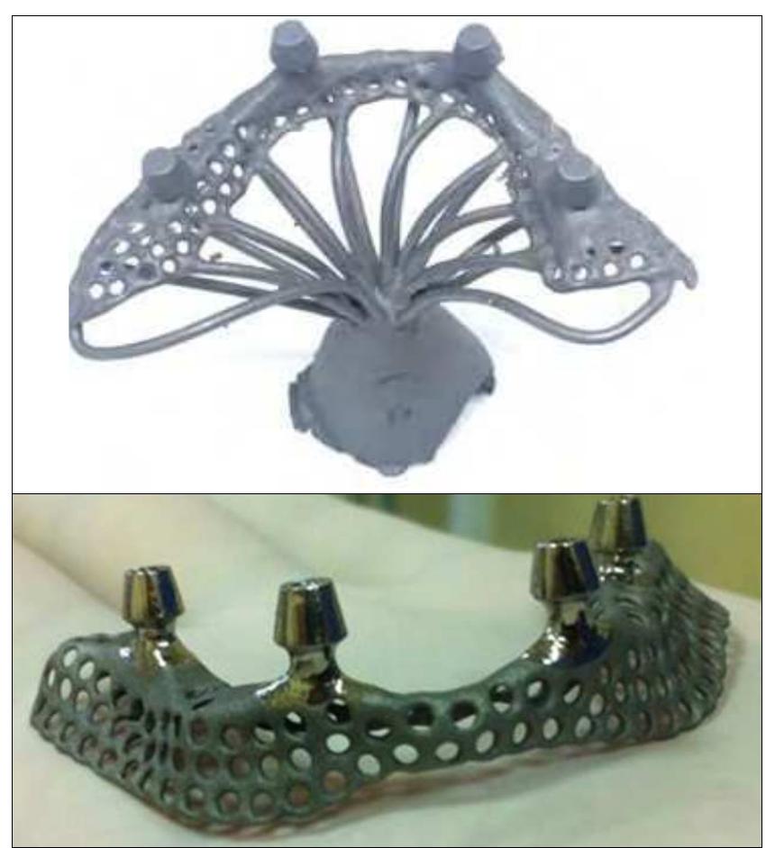 Raw cast of one-piece titanium metal struc- ture, and the