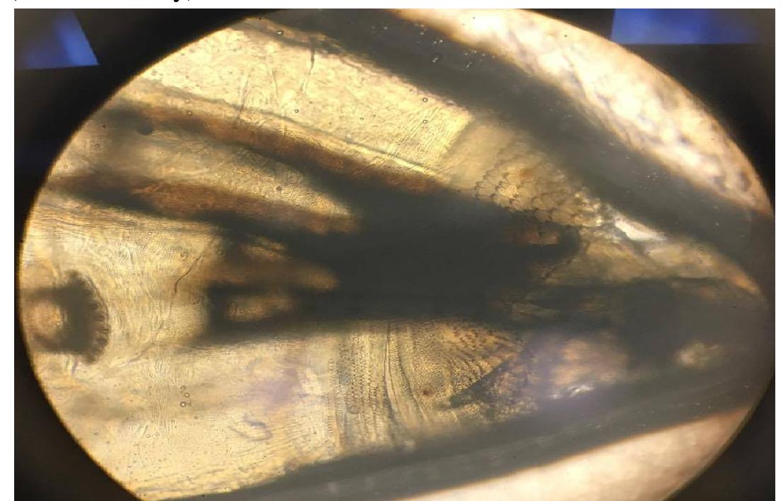 -2: a microscopic image showing the mouthparts/spines of