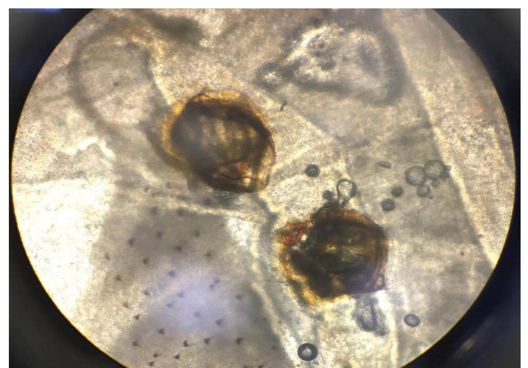 -5: a microscopic image showing the posterior spiracles of