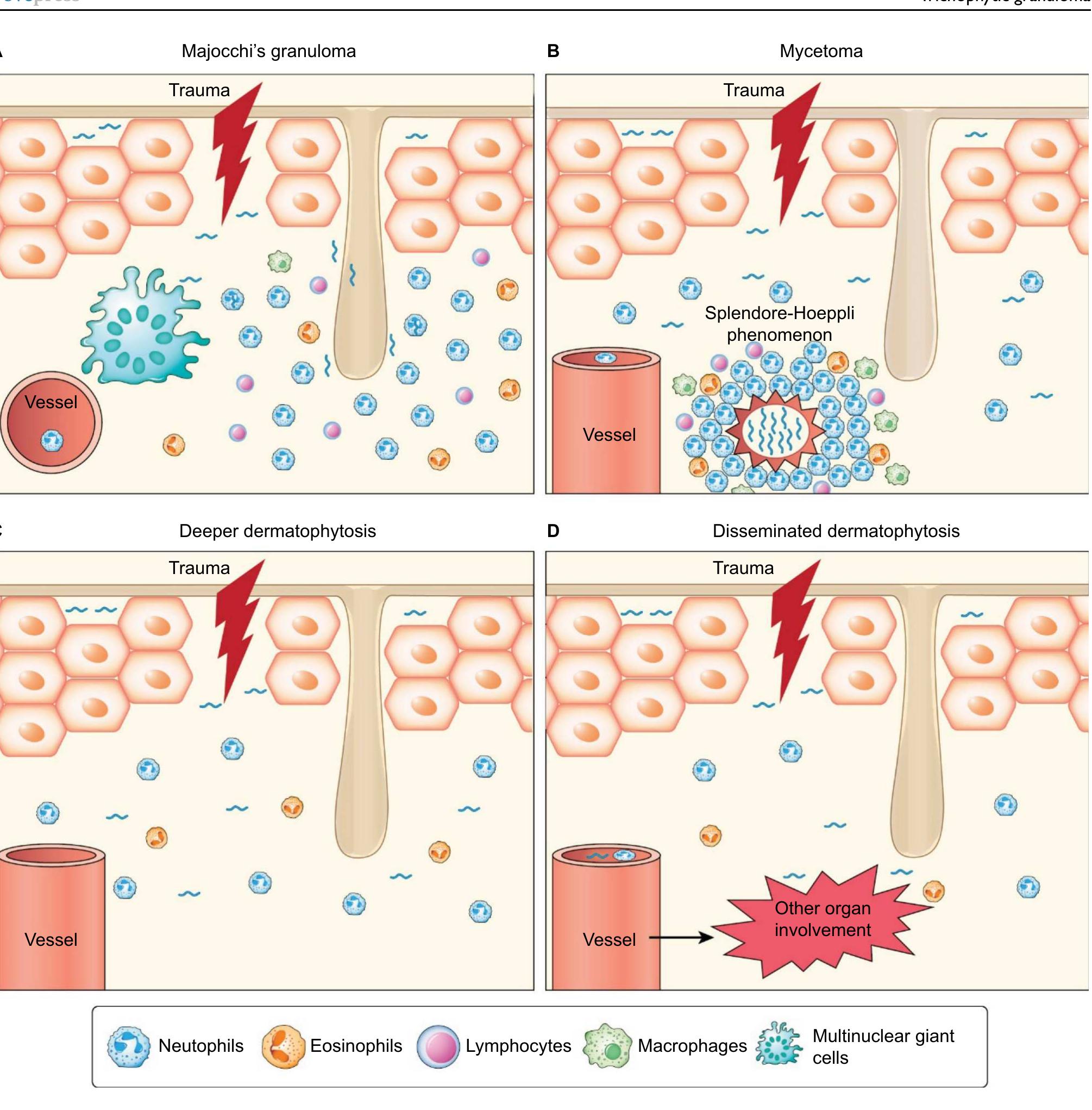 | pathogenesis of invasive dermatophytosis. notes: physical