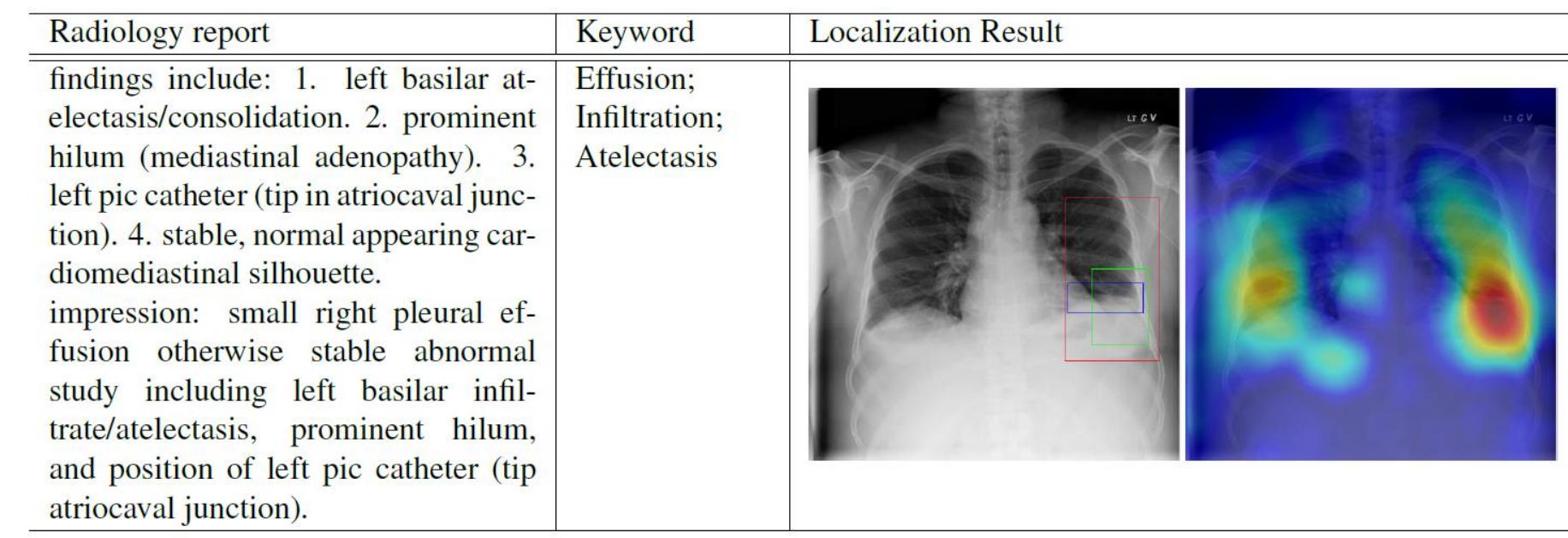 A sample of chest x-ray radiology report, mined disease