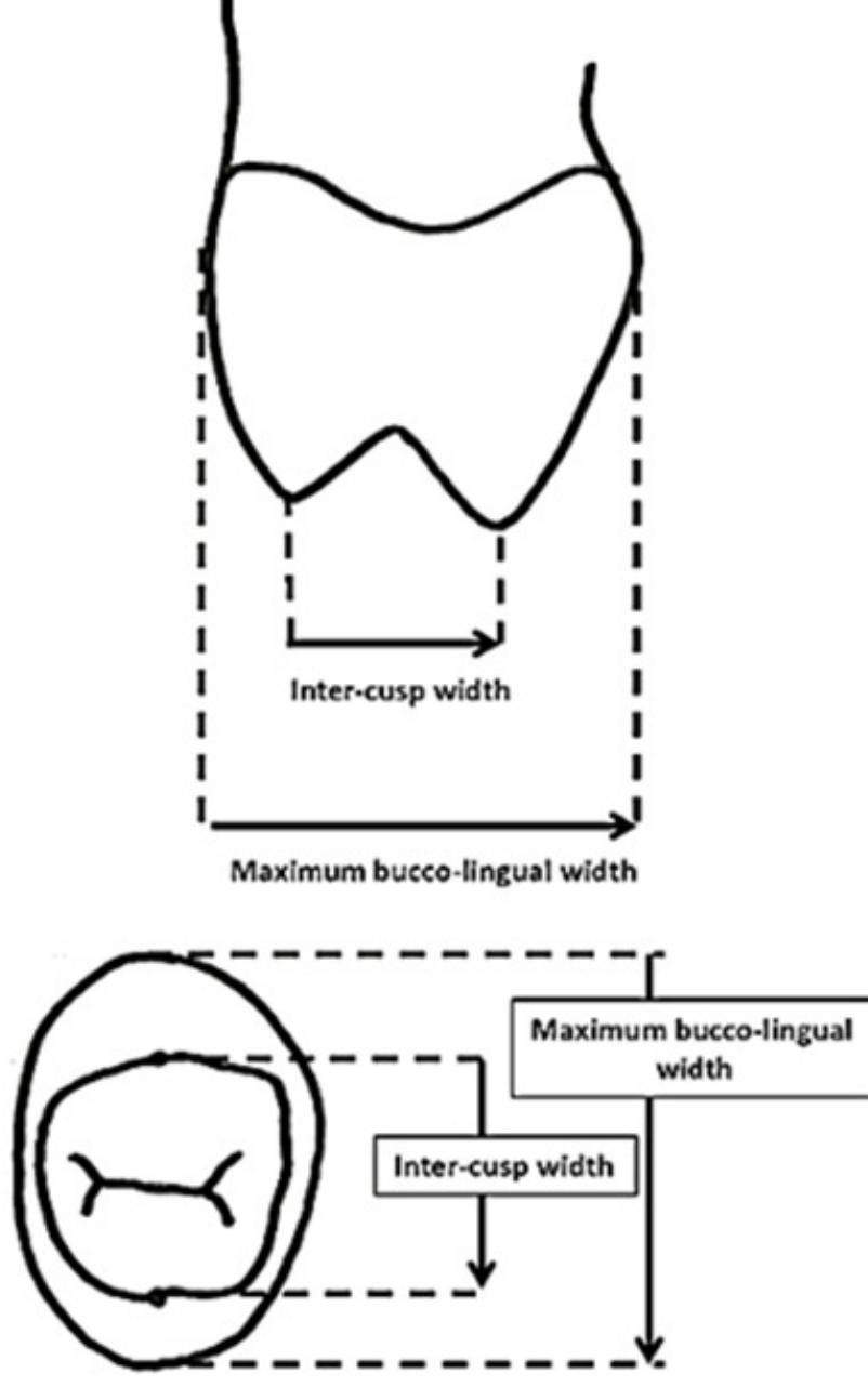 Schematic measurement of side and chewing surface view of