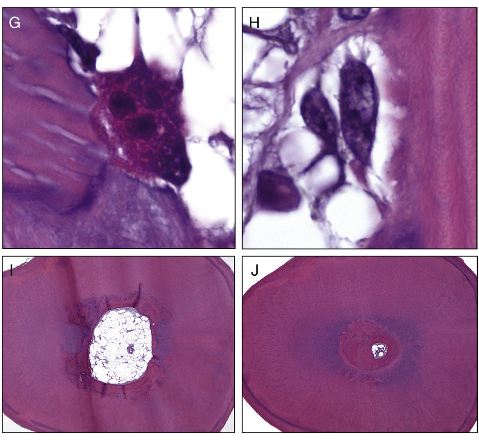 Tially balloon out. internal root resorption lesions might