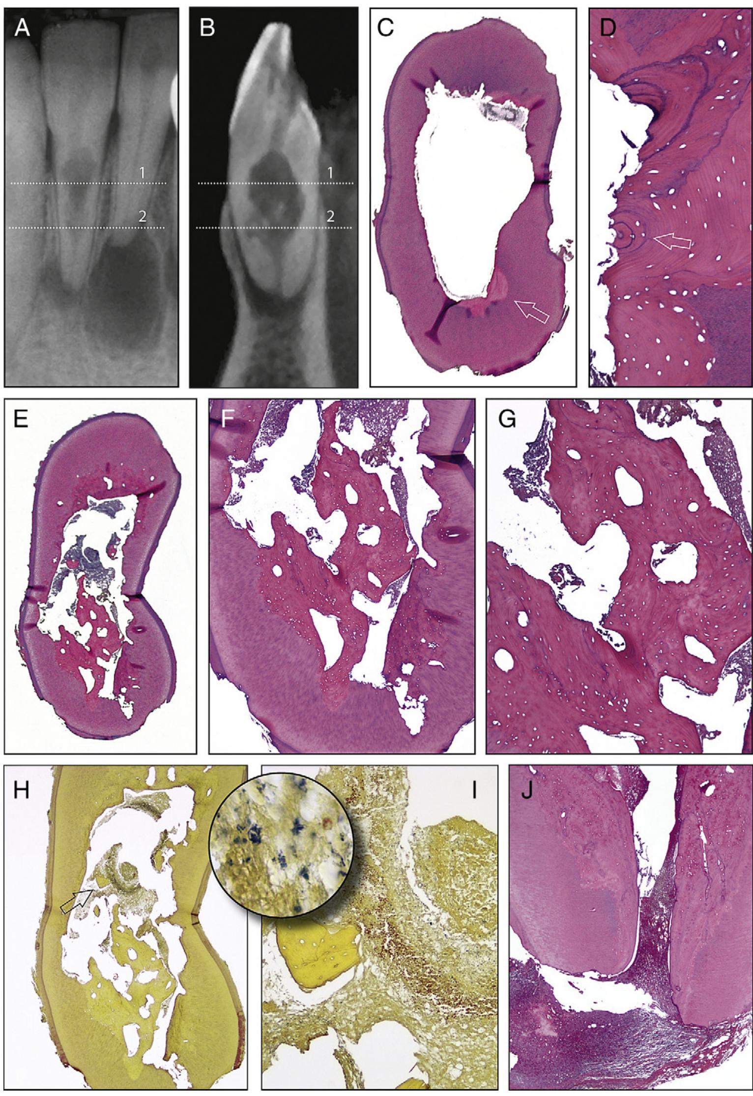 Light microscopy images of a variant of internal (root