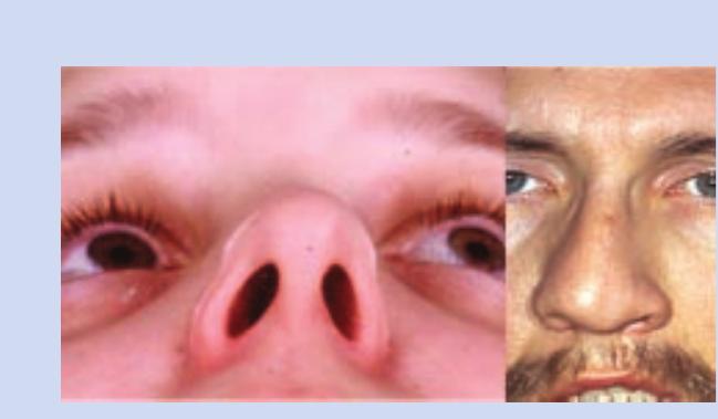 (PDF) Elements of morphology: Standard terminology for the nose and ...