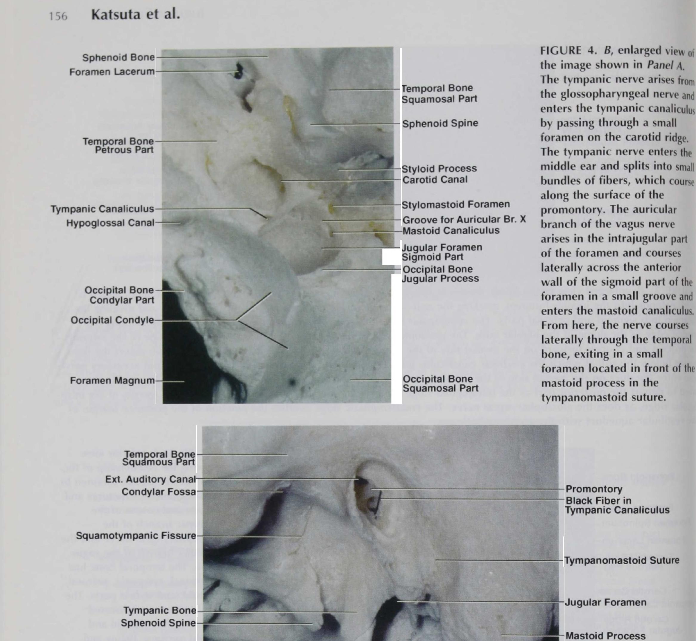 Figure 8 - The Jugular Foramen: Microsurgical Anatomy and