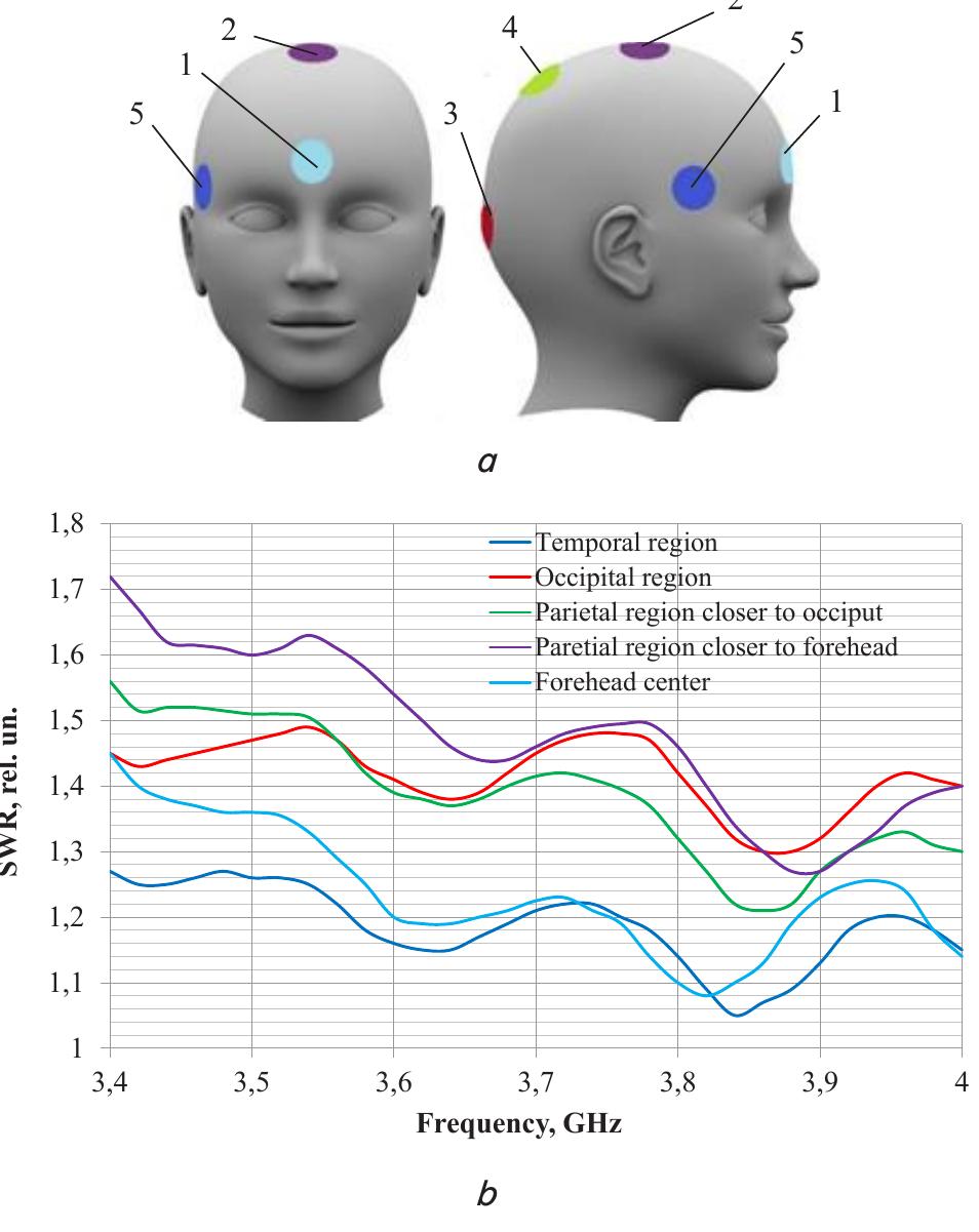 Measurement of swr in various points on human head: the