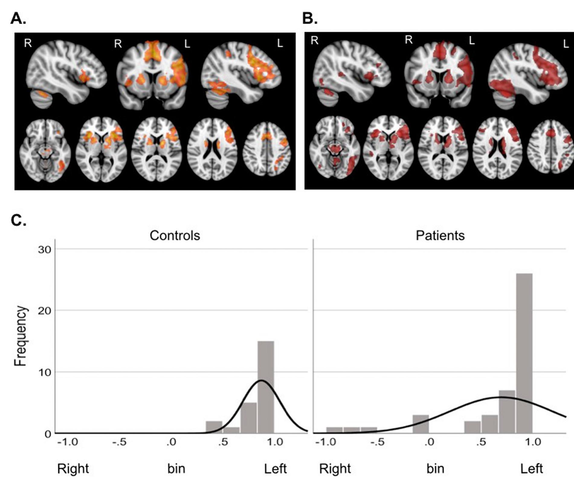 Group fmri activation maps and lis during letter fluency.