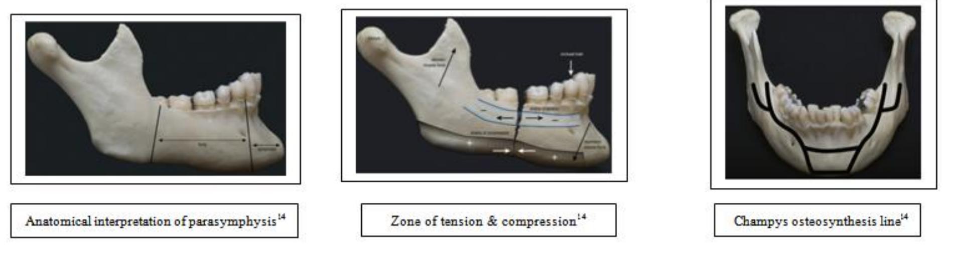 From a biomechanical aspect, the mandible represents two