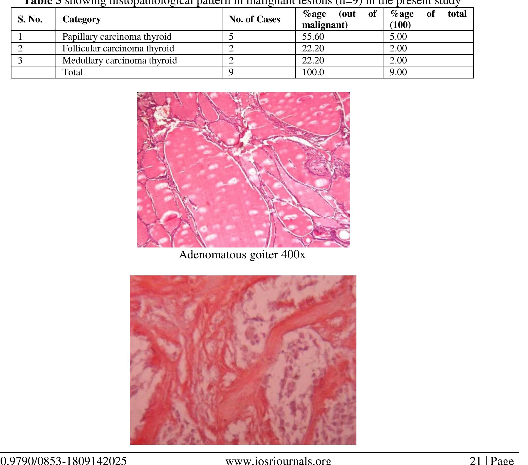 Figure 1 Histopathological Spectrum Of Thyroid Lesions A