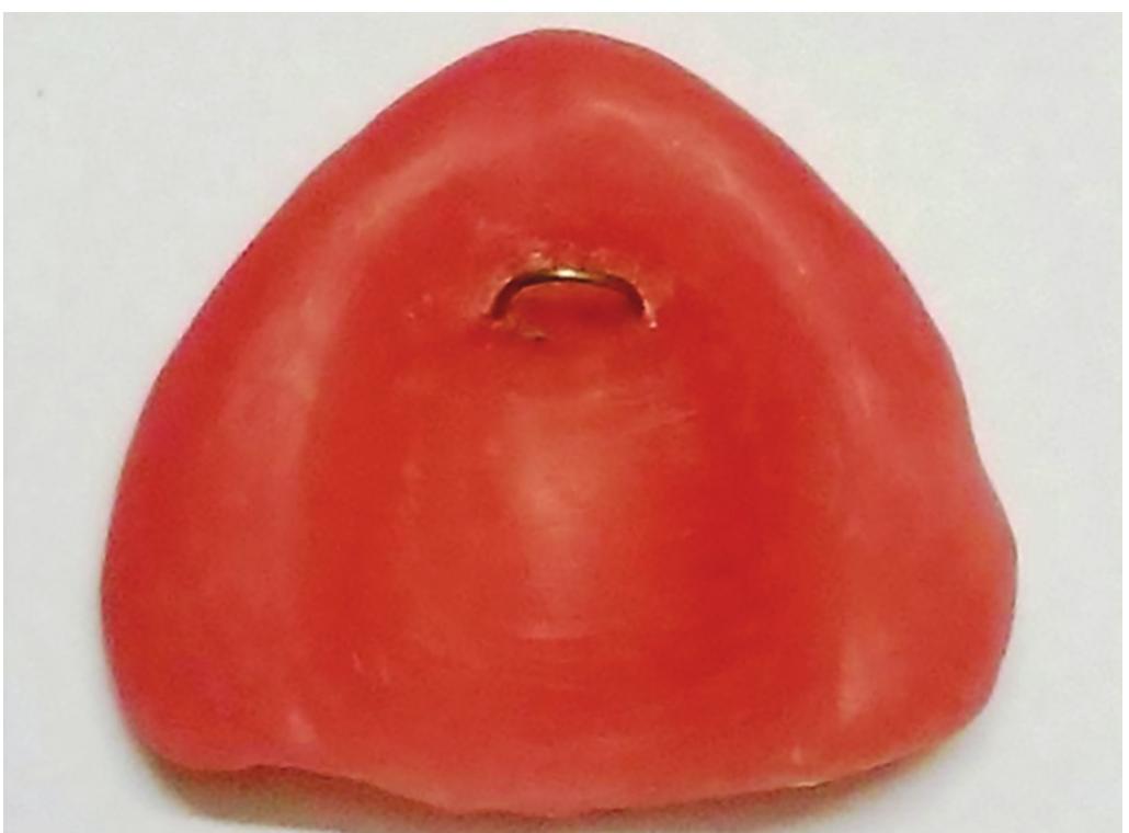Finished denture base with wire loop at the anterior palatal